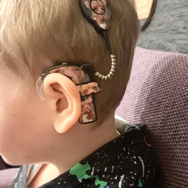 STICKER SET for Cochlear Implants and Hearing Aids - Etsy