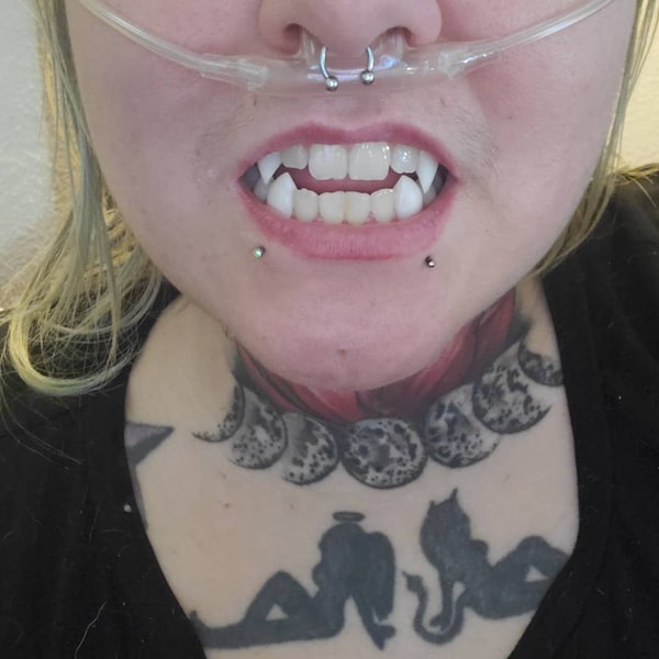 Cat Fangs (please Read Item Description!) - Etsy