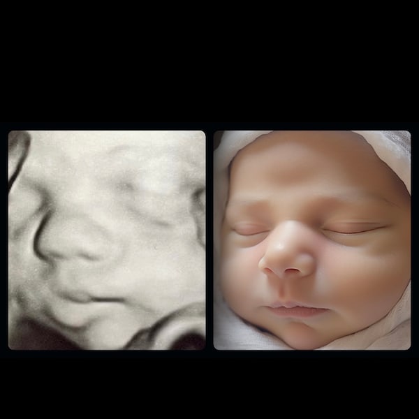 Ultrasaund 8k Baby Image 3d 4d 5d 8d Real View Baby AI Photo ...