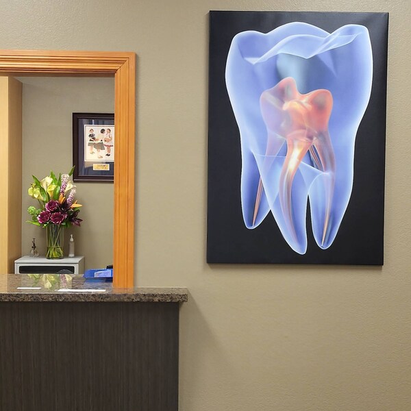 X-ray Molar Tooth, Dental Art, Dentist Art, Dental Clinic Deco Canvas ...