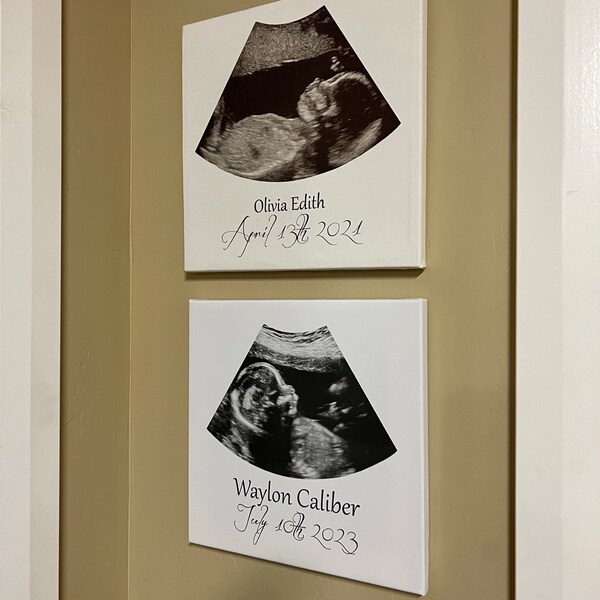 Sonogram Print, Nursery Wall Art, A Personalized Ultrasound Canvas ...