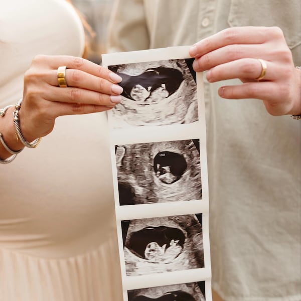 Traditional Ultrasound Strip - Upload Your Digital Images - Etsy