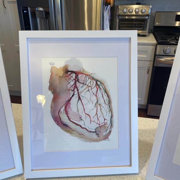 Coronary Angiogram Watercolor Print - Cardiology Painting - Heart Art ...