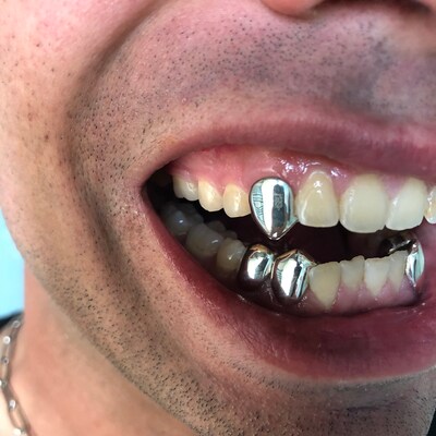 Handmade Custom .925 Sterling Silver Top Fangs With Bottom Wolf Style ...