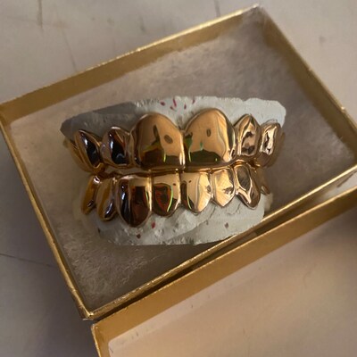 The BEST Mold Kits for Grillz Mold Impression Kit for Custom Grillz ...