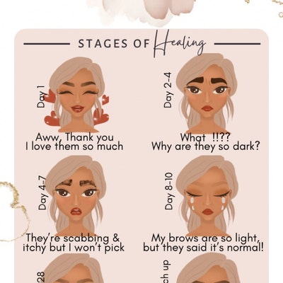 Lip Filler Stages of Healing With Hand Drawn Illustrations, Hyaluron ...