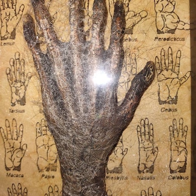 Bizarre 6 Finger Mummified Hand With Jar Oddity Medical Gaff - Etsy