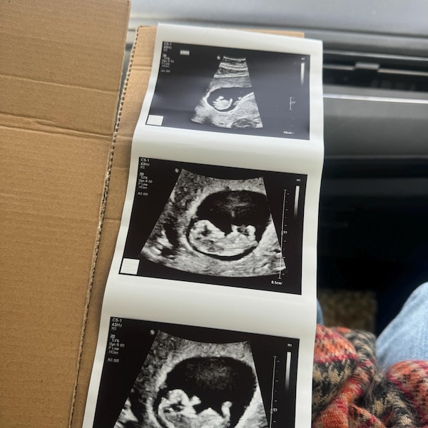 Traditional Ultrasound Strip - Upload Your Digital Images - Etsy