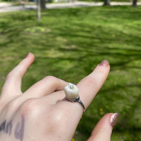Trio Teeth Ring. Available With/ Without Braces! Gem Cavities Also ...