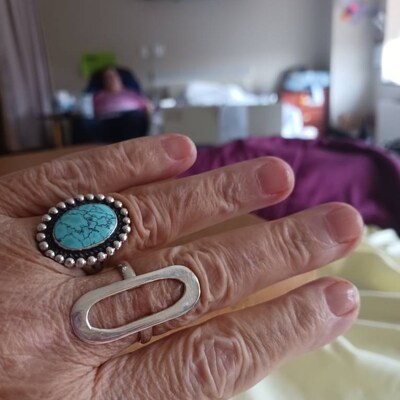 Arthritis EDS Finger Splint Adjustable for All Types of Deviation ...