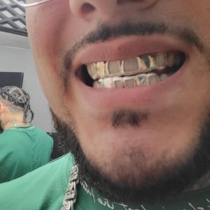 Sterling Silver Grillz 925 Custom Silver Teeth Real Open Face Silver ...