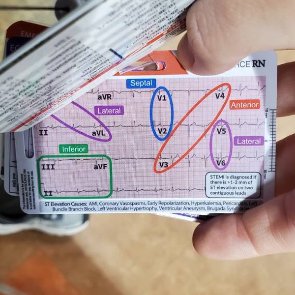 EKG STEMI Reference Tool - Horizontal and Vertical Badge Card Pocket ...