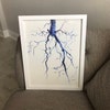 Aorta Angiogram Watercolor Art Print - Cardiovascular Painting - Blood ...