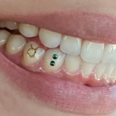 18k Gold LOGO Tooth Gems - Etsy
