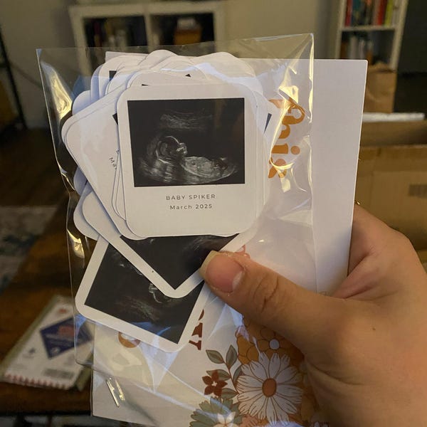 Baby Shower Decorations | Ultrasound Confetti | Custom Decorations Baby ...