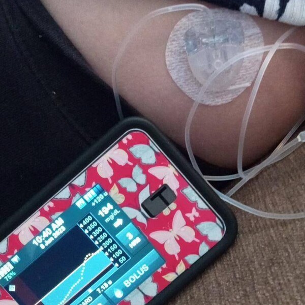 Digital Download - Cut File - Personal Use Only - Omnipod(eros, Dash, and Omnipod 5) Low Profile ...