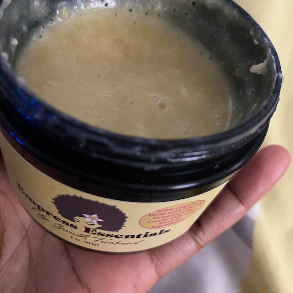 Hair Loss Treatment Hair Growth Cream 2 Month Supply Balding Alopecia ...