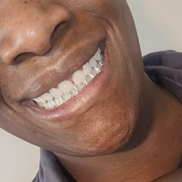 Silver Grillz 925 Sterling Silver Teeth Real Open Face Silver Grill - Etsy