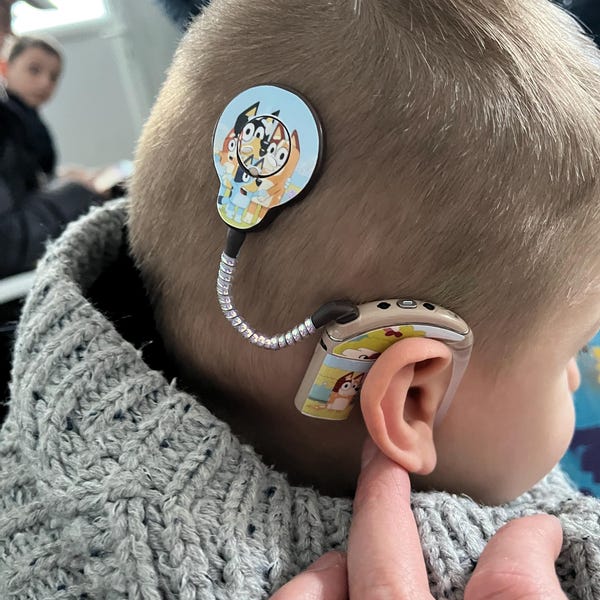 Cochlear Implant Skins Cochlear Implant Stickers - Etsy