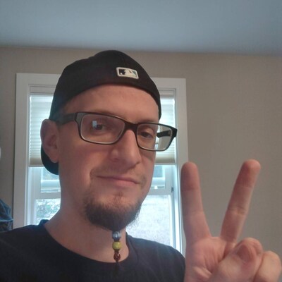 Goldfish Dread Beads Set/7-15mm Hole/glass Dreadlock - Etsy