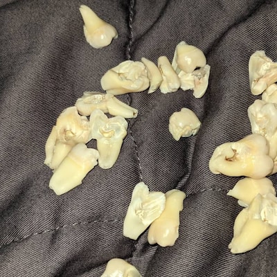 10 Real Human Teeth molars, Premolars, & Anteriors - Etsy