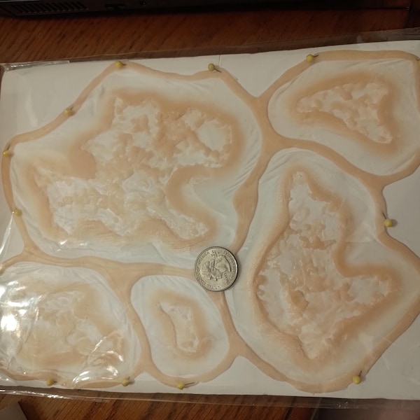 Cyst Growth Pack / Boils / Encapsulated Silicone Prosthetic / Abscess ...