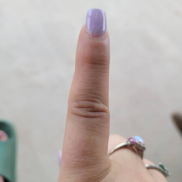 Arthritis Finger Splint Ring, 925 Sterling Solid Silver Ring,arthritis ...