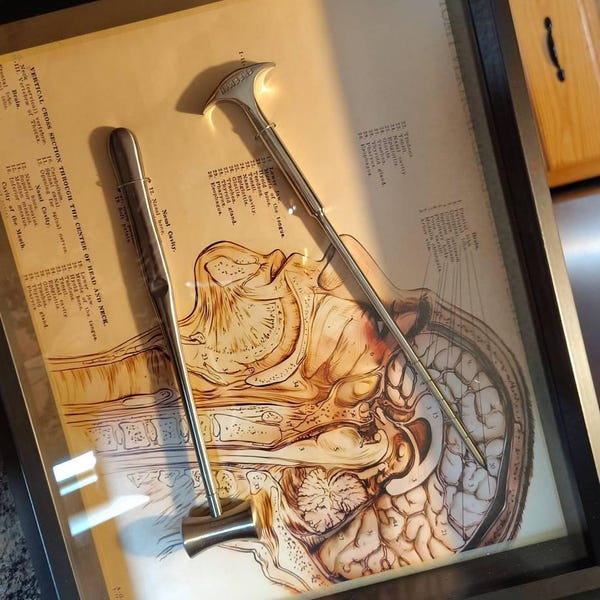 BESTSELLER! Lobotomy Shadowbox Display Large - Etsy