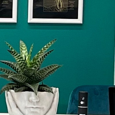 4 Botox Posters, Beauty Salon Decor, Real Foil Print, Botox Aftercare ...