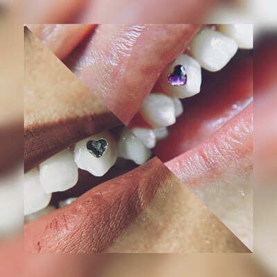 Gold 18K Tooth Gem - Etsy