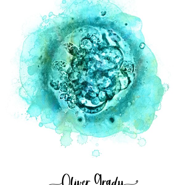 IVF Watercolor Art Medical Art Print Doctor Wall Art OBGYN Decor ...