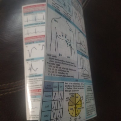 EKG Pocket Guide - Etsy
