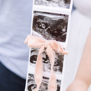 White Eyelet Pigtail Bows Girls Hair Accessories Piggy Tail - Etsy