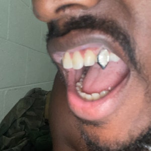 Real Solid 10K Gold Double Side Canine Teeth Custom Grillz - Etsy
