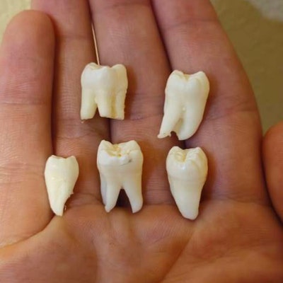 One Real Human Tooth Pendant Necklace - Etsy