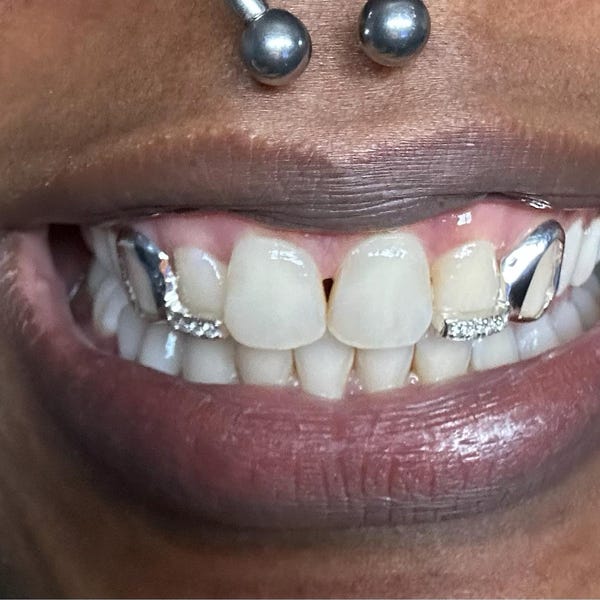 Custom Open Face Canines With Gap Bar 8k, 10k, 14k or Silver Yellow ...