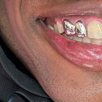 Real Solid 10K Gold Double Side Canine Teeth Custom Grillz - Etsy