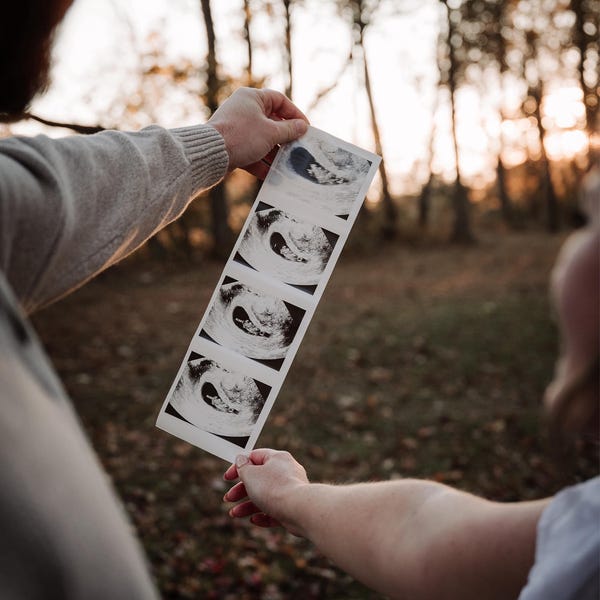 Traditional Ultrasound Strip - Upload Your Digital Images - Etsy