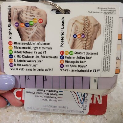 EKG 12 Lead Placement Horizontal Badge Card - Etsy