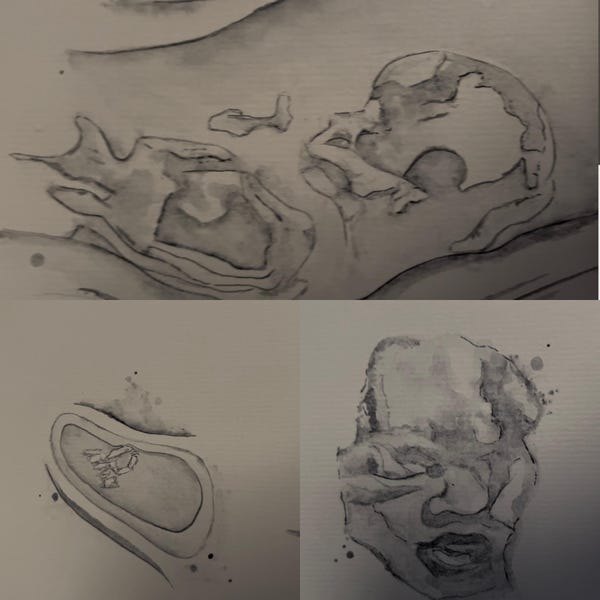 Embryo Art | Ivf Painting | Embaby Art | Hand-painted Nursery Decor ...