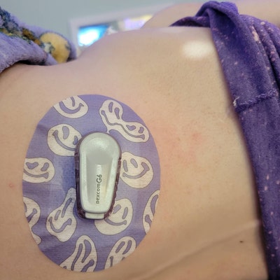 Wonky Smiley Face Dexcom G6 Overlay Patch - Etsy