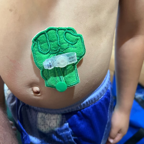 Super Hero’s G-tube Pads/g Tube Covers/mic-key AMT Mini One Feeding ...