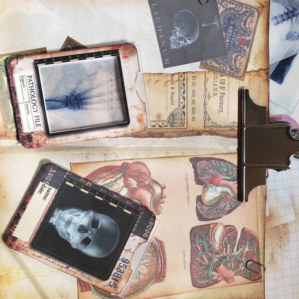 X-ray Slides With Tray, Human Skeleton, Vintage Medical Pathology Cards ...