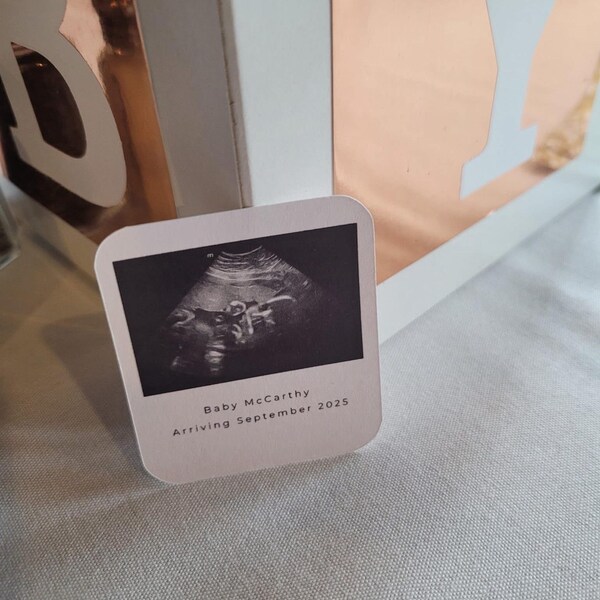 Baby Shower Decorations | Ultrasound Confetti | Custom Decorations Baby ...