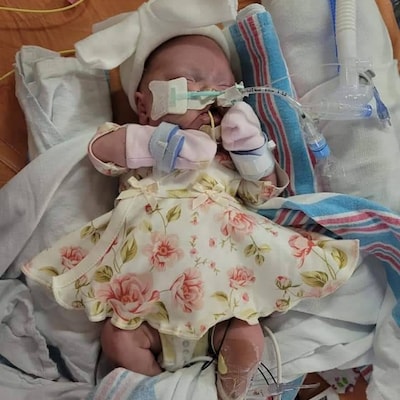 NICU Dress Set, Nicu Wrap, Preemie Baby Clothes, Clothes for Preemies ...