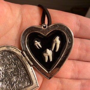 Loose Tooth Locket Ring - Etsy
