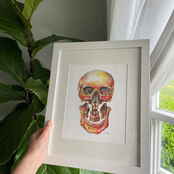 Le Fort I Watercolor Art Print - Maxilla Surgery Abstract Anatomy Art ...