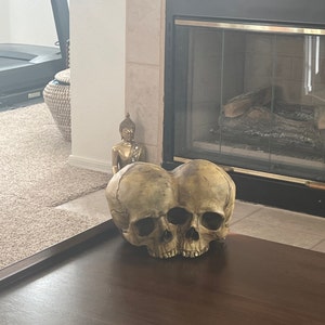 Conjoined Twins Human Skull FREE SHIPPING - Etsy