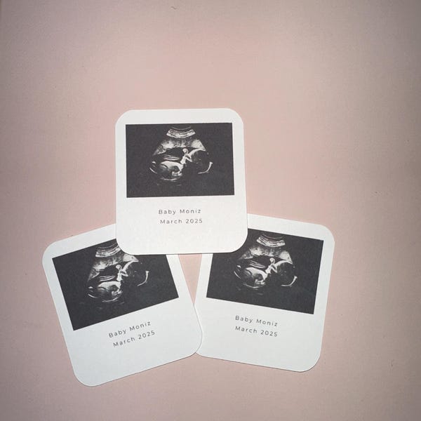 Baby Shower Decorations | Ultrasound Confetti | Custom Decorations Baby ...