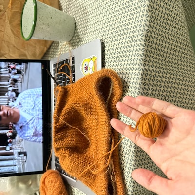 Buttons for Cardigan Buttons for Knitting Marble Buttons Sweater ...